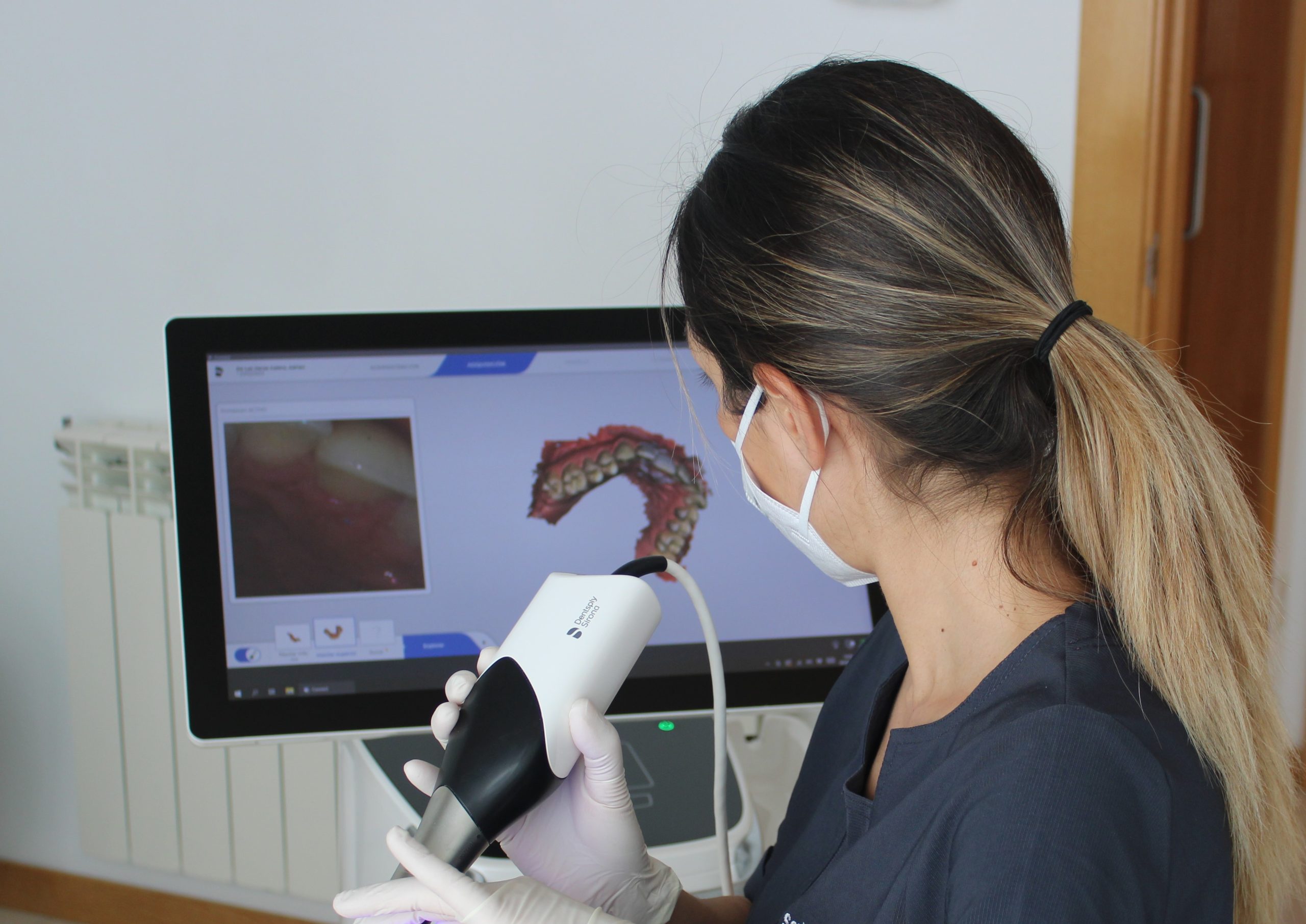 Escáner intraoral
